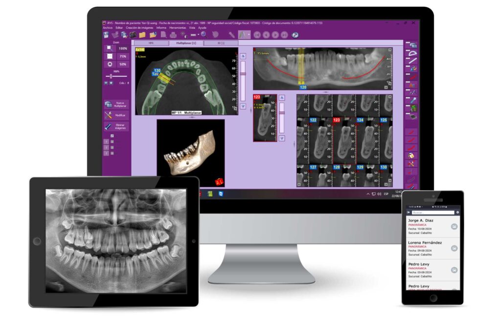TCMax líderes en tomografía y radiología dental - TCMax Online