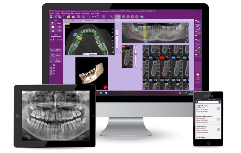 TCMax líderes en tomografía y radiología dental - TCMax Online